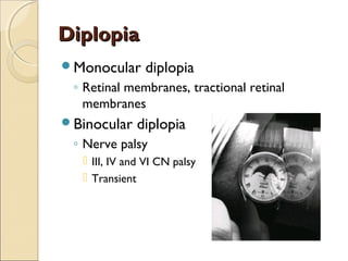 Visual Implication in Diabetes Mellitus | PPT