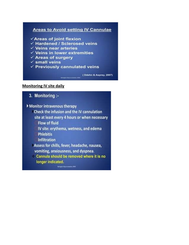 Visual infusion phelibitis checklist for direct patient care | DOCX