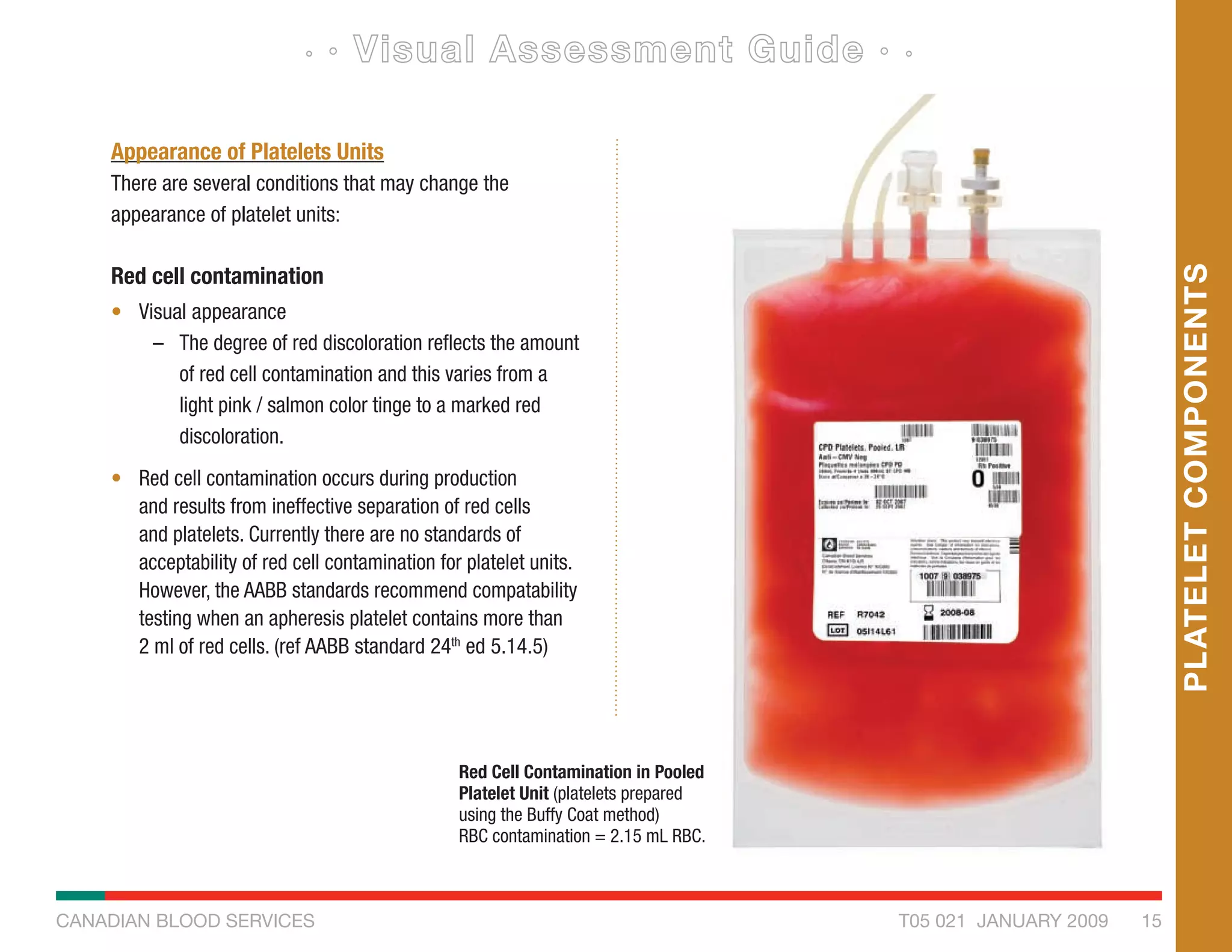Visual inspection guide for blood compopnents | PDF