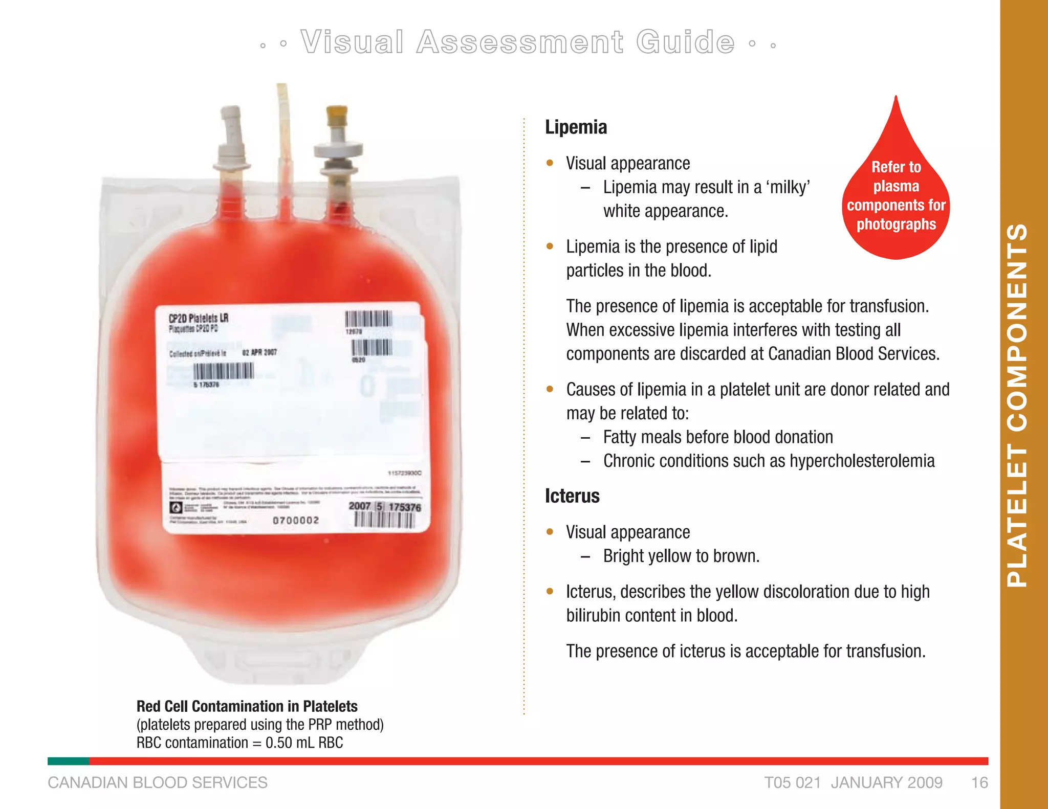 Visual inspection guide for blood compopnents | PDF