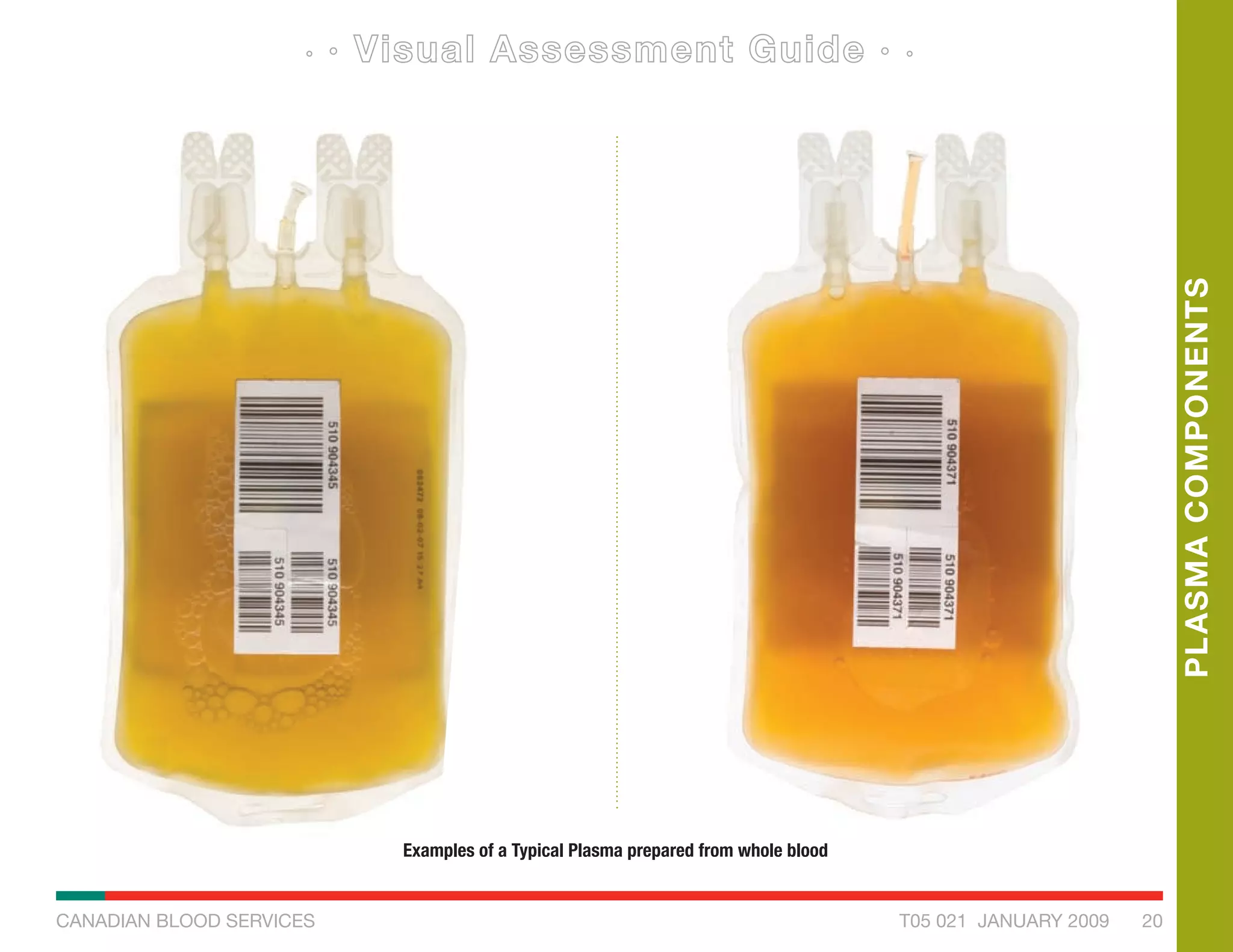 Visual inspection guide for blood compopnents | PDF