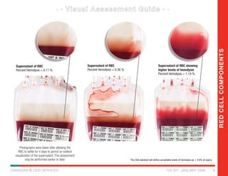 Visual inspection guide for blood compopnents | PDF