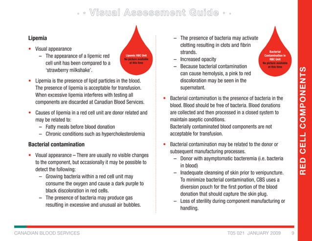 Visual inspection guide for blood compopnents | PDF
