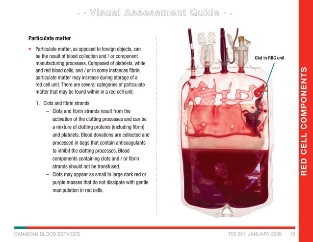 Visual inspection guide for blood compopnents | PDF