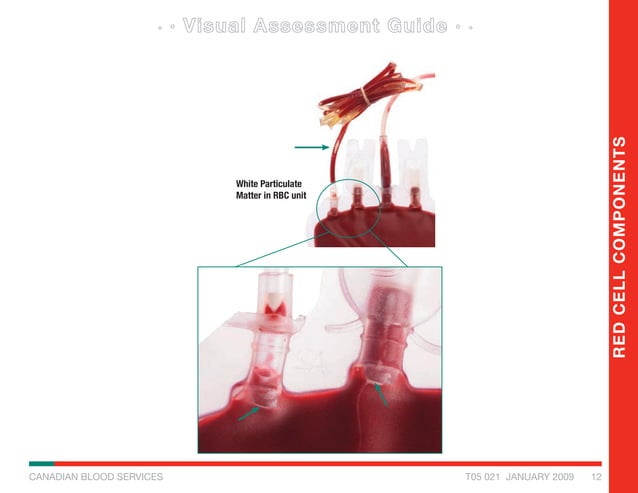 Visual inspection guide for blood compopnents | PDF