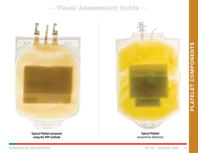 Visual inspection guide for blood compopnents | PPT