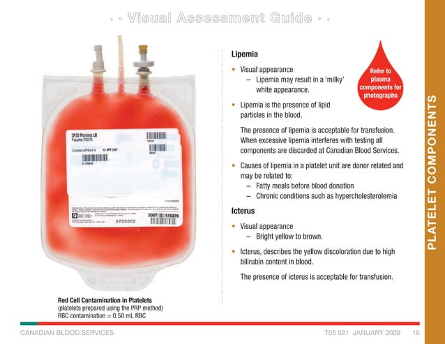 Visual inspection guide for blood compopnents | PDF