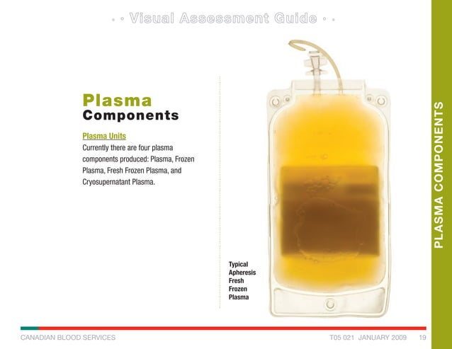 Visual inspection guide for blood compopnents | PDF