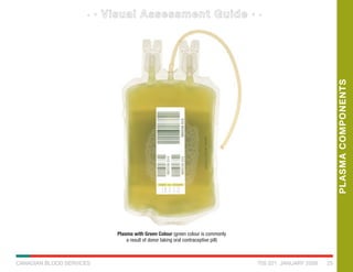 Visual inspection guide for blood compopnents | PDF