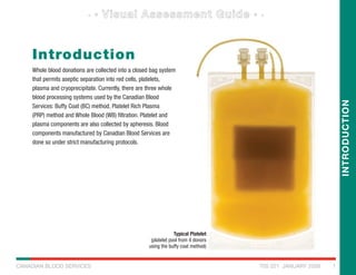 Visual inspection guide for blood compopnents | PDF
