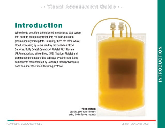 Visual inspection guide for blood compopnents | PDF