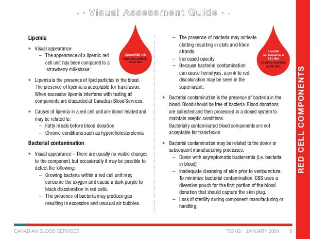 Visual inspection guide for blood compopnents