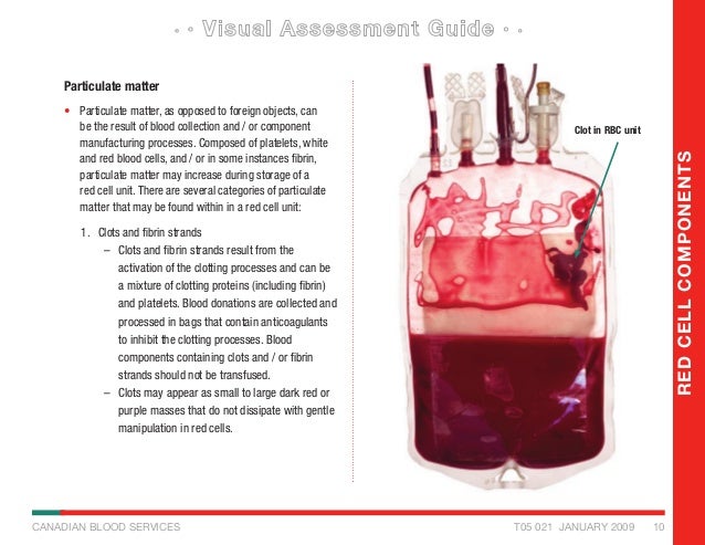 Visual inspection guide for blood compopnents