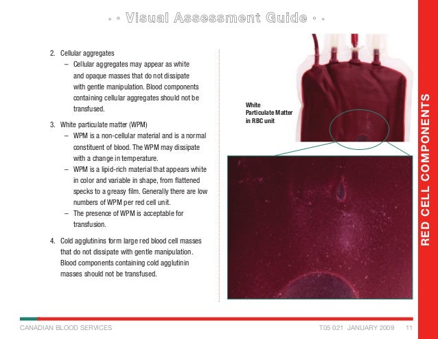 Visual inspection guide for blood compopnents