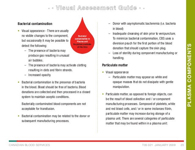 Visual inspection guide for blood compopnents