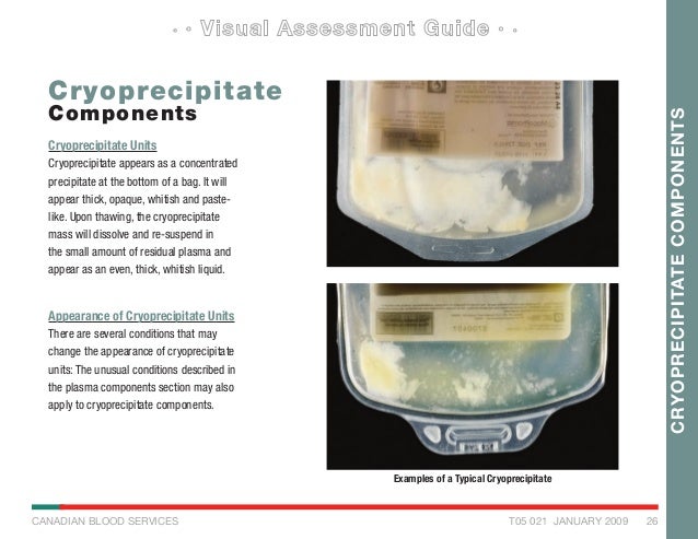 Visual inspection guide for blood compopnents