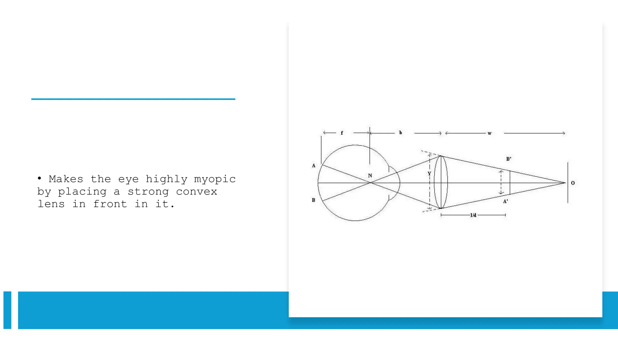 mastering visualization of posterior segment | PPT