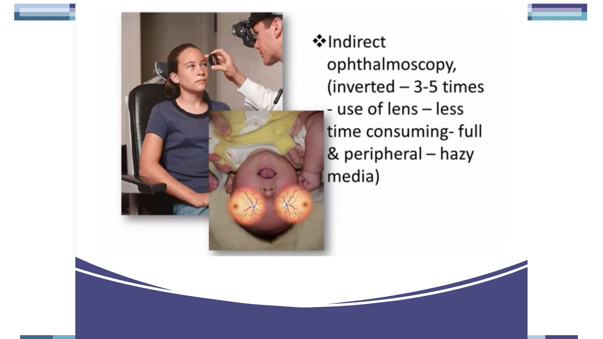 mastering visualization of posterior segment | PPT