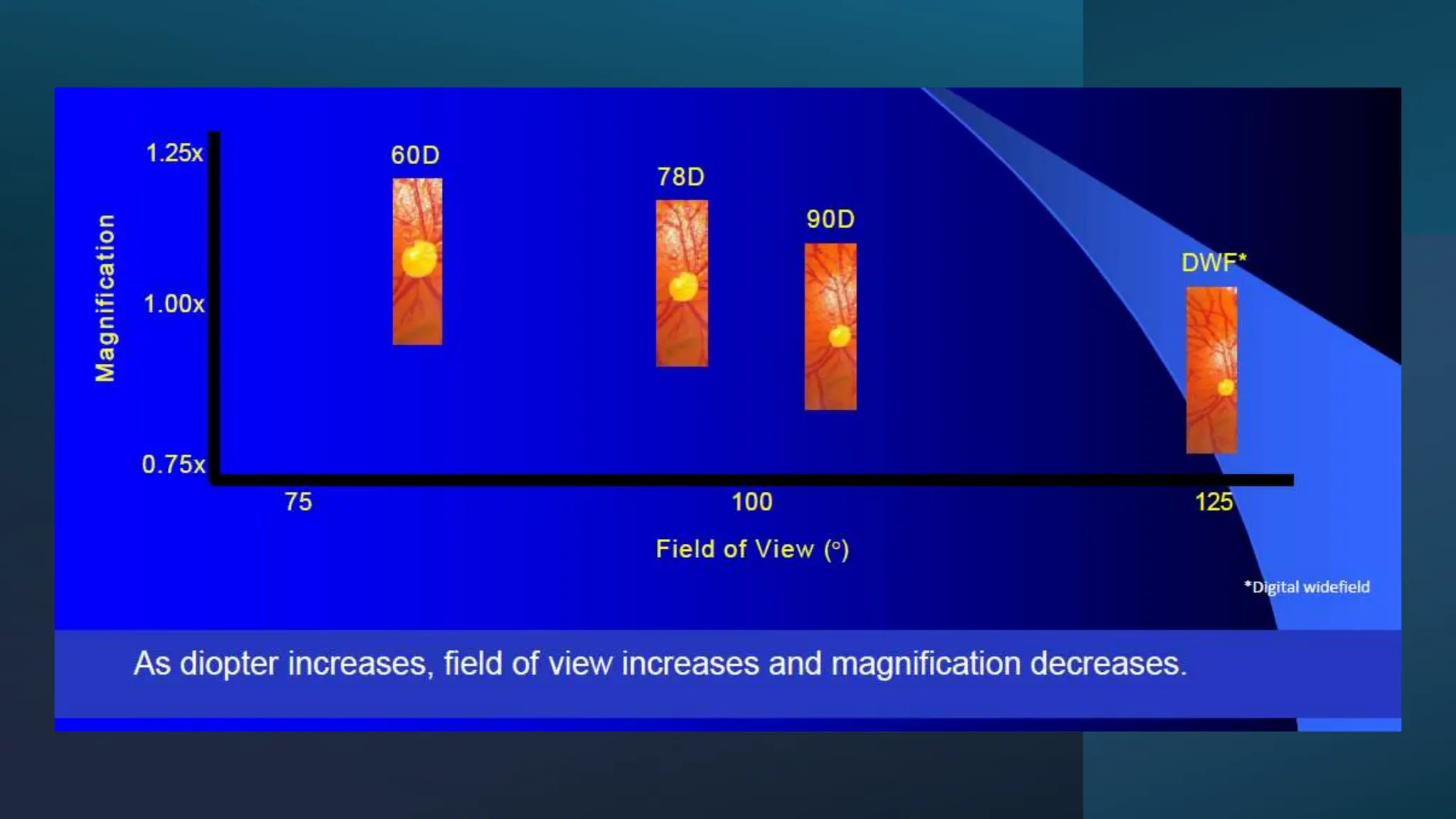 Mastering Visualization Of Posterior Segment Ppt