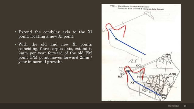 Visualized treatment objective(vto) | PPTX