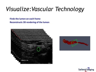 Visualize vascular (slides) | PPT