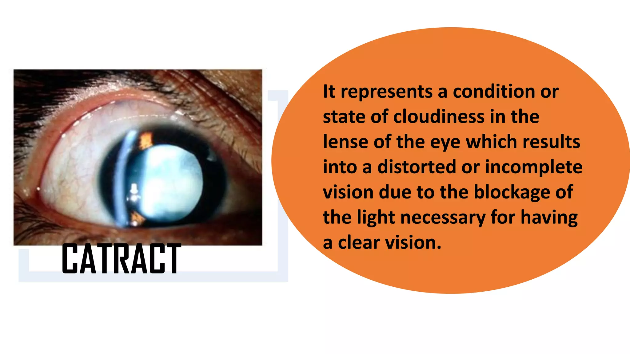 Visually ipaired children | PDF