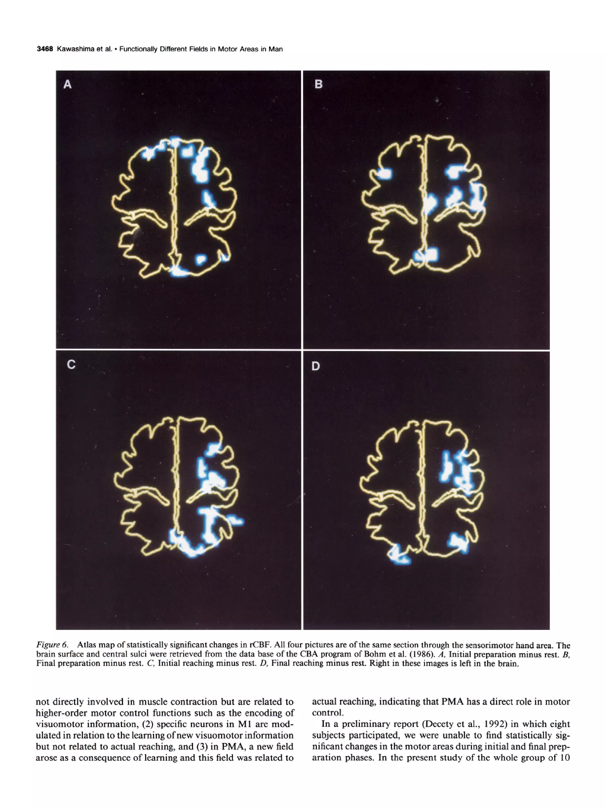 Visuomotor Learning: A Positron Emission Tomography Study by Ryuta Kawashima, Per E. Roland, and ...
