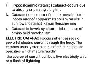 Cataract | PDF