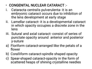 Cataract | PPT