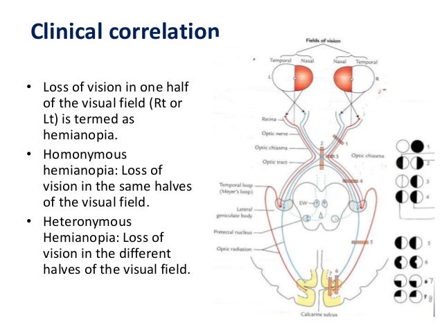 Visual pathway and defects