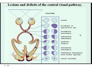 Visual pathway | PPTX