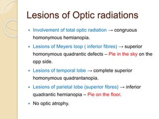 Visual pathway | PPTX