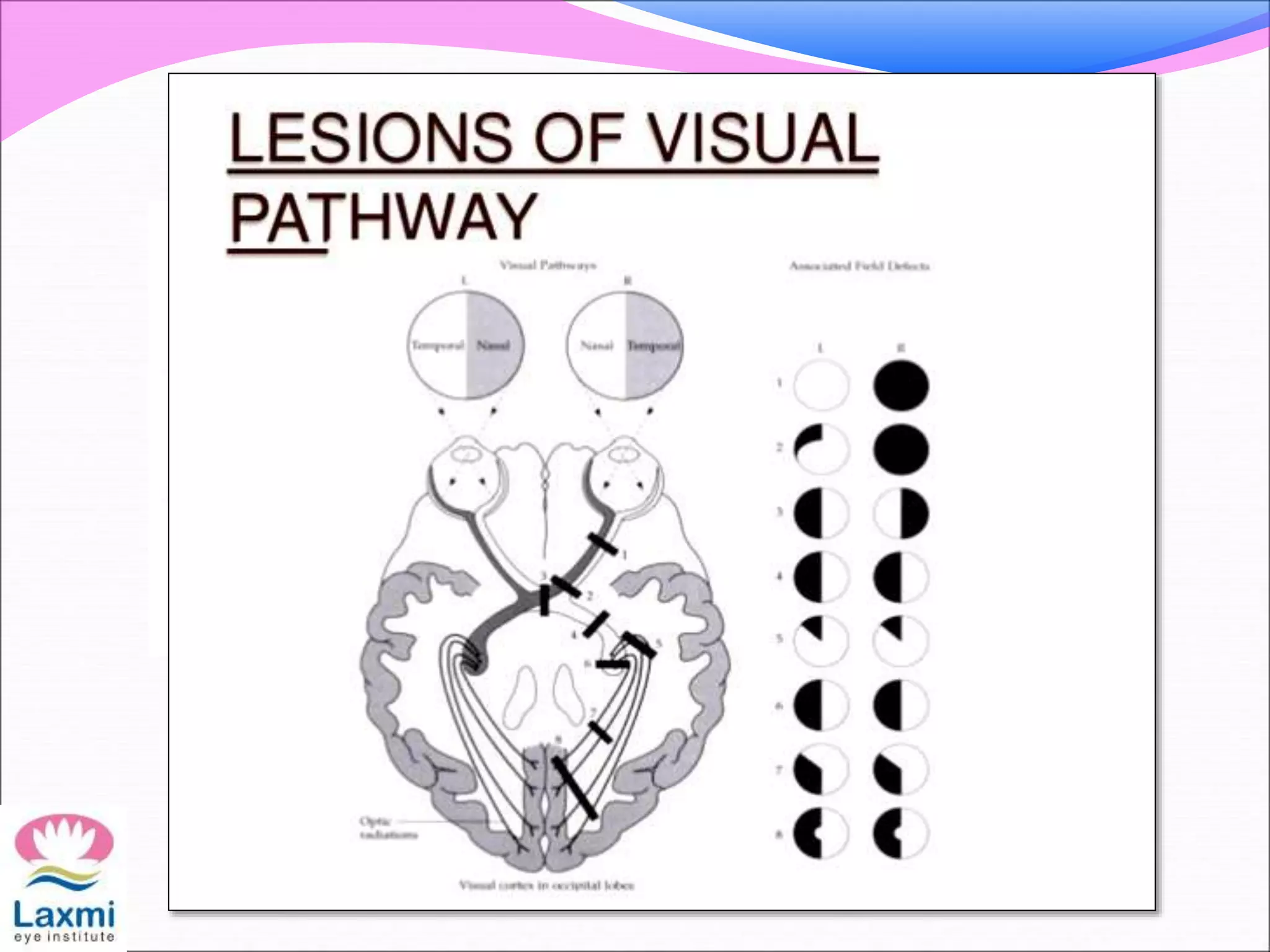 Visual pathway | PPTX