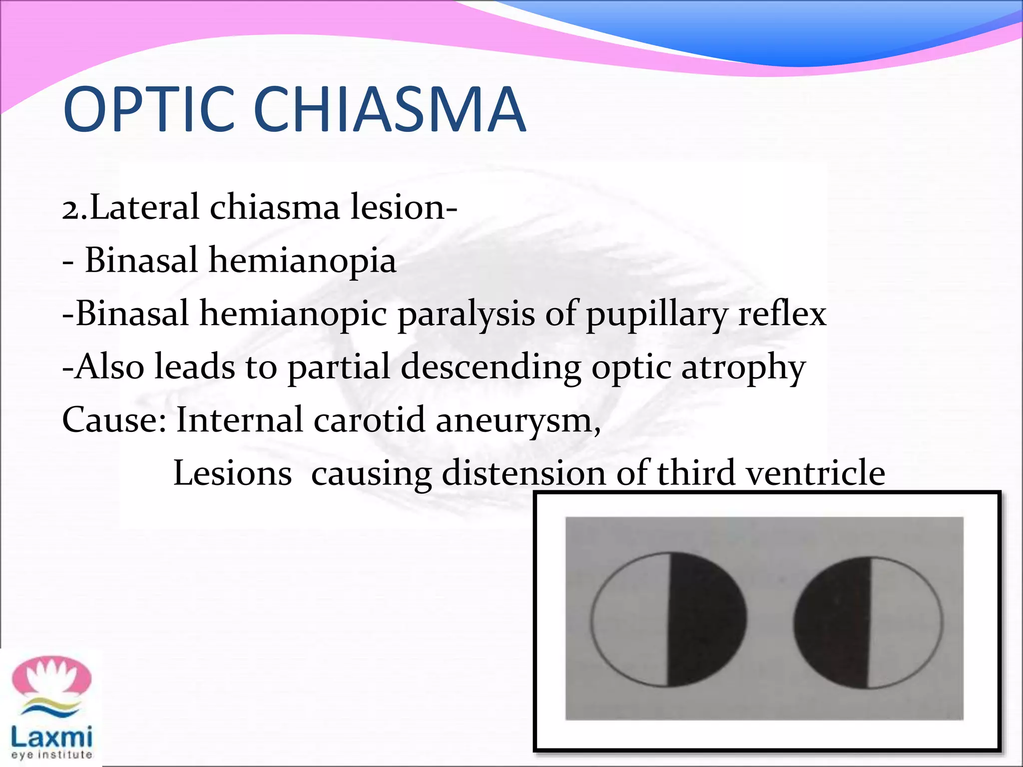 Visual pathway | PPTX