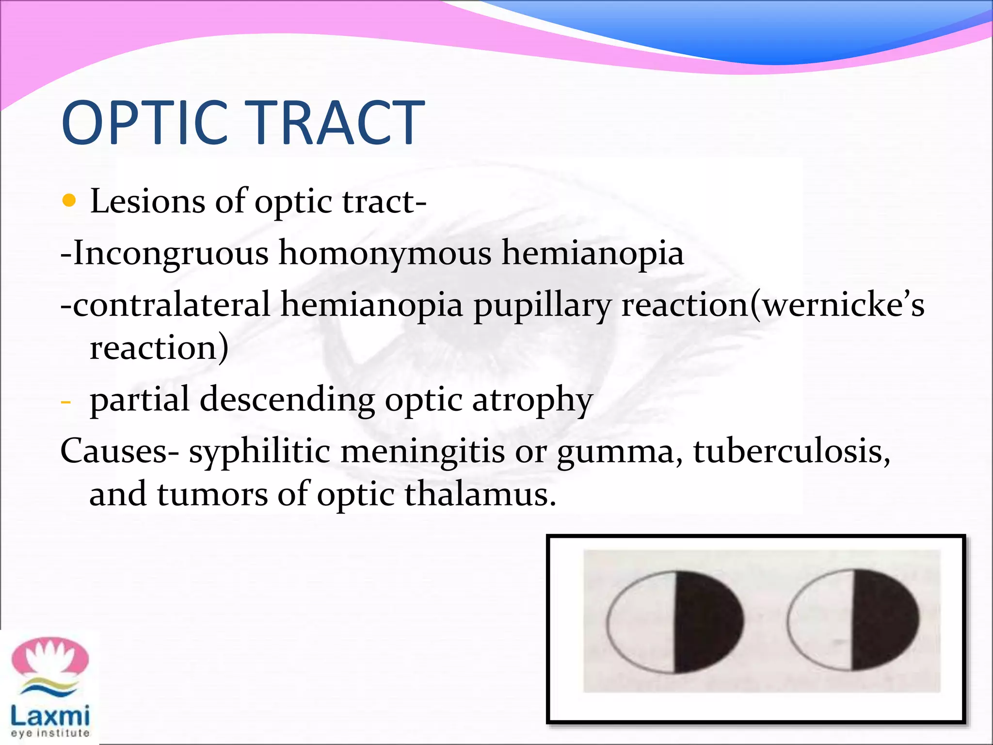 Visual pathway | PPTX