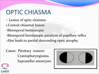 Visual pathway | PPTX