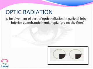 Visual pathway | PPTX