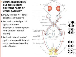 Visual pathway | PPT
