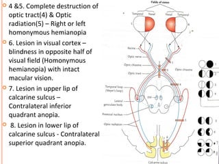 visualpathway-170222022827 (1).pdf