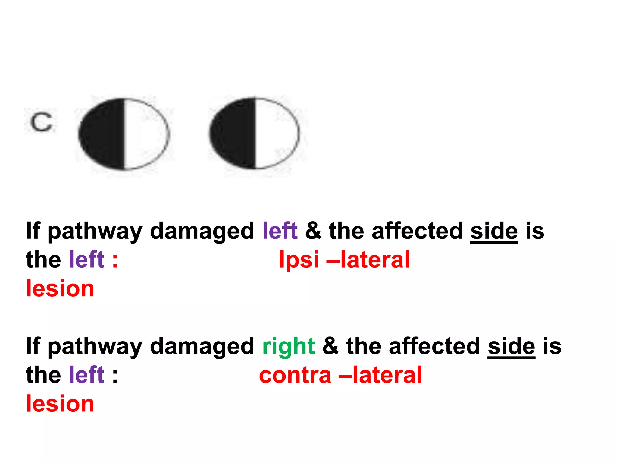 Visual pathway & lesions | PPTX