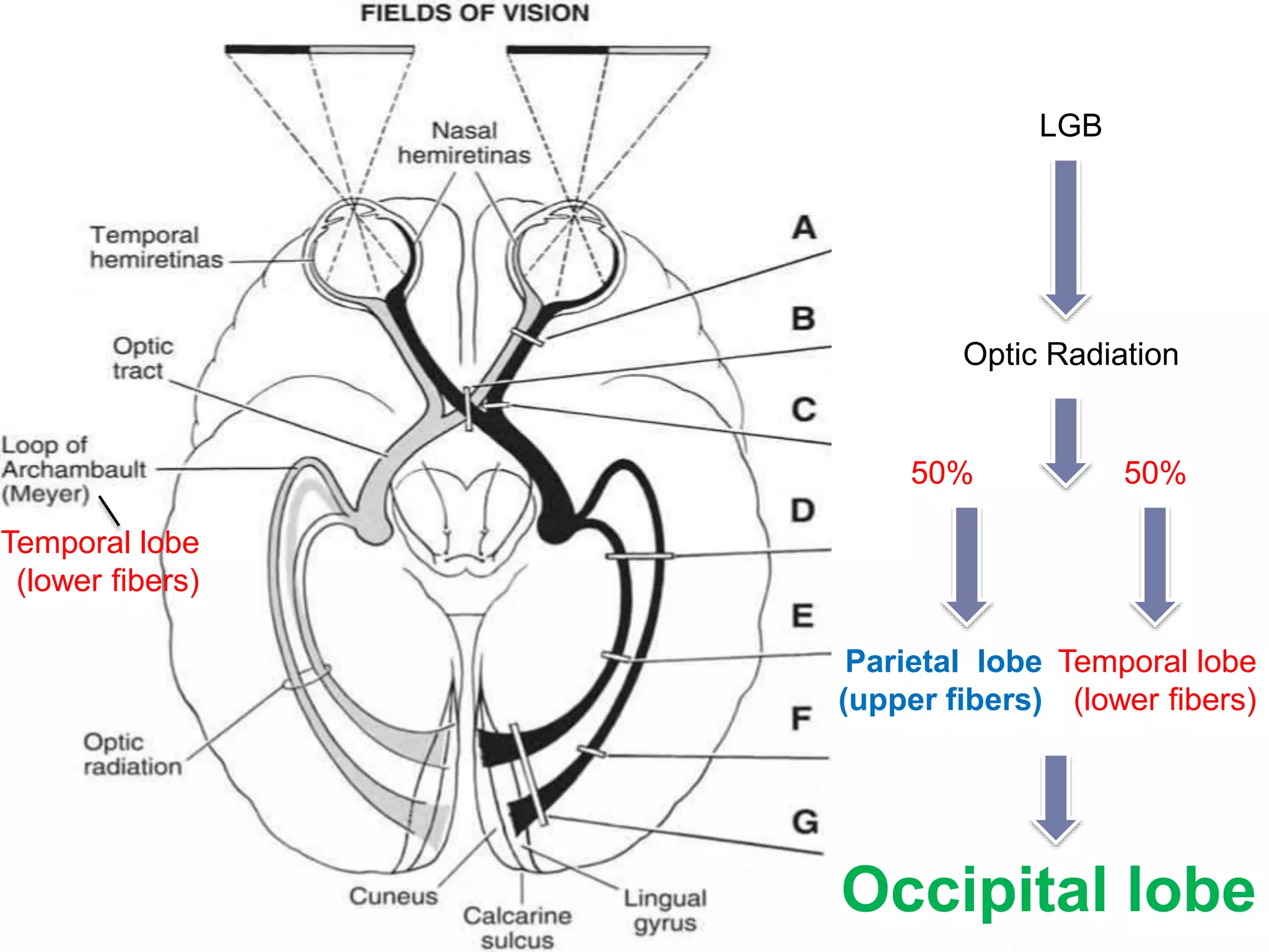 Visual pathway & lesions | PPTX