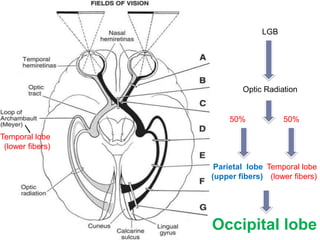Visual pathway & lesions | PPTX