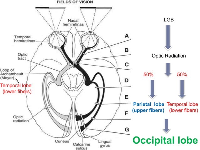 Visual pathway & lesions | PPTX