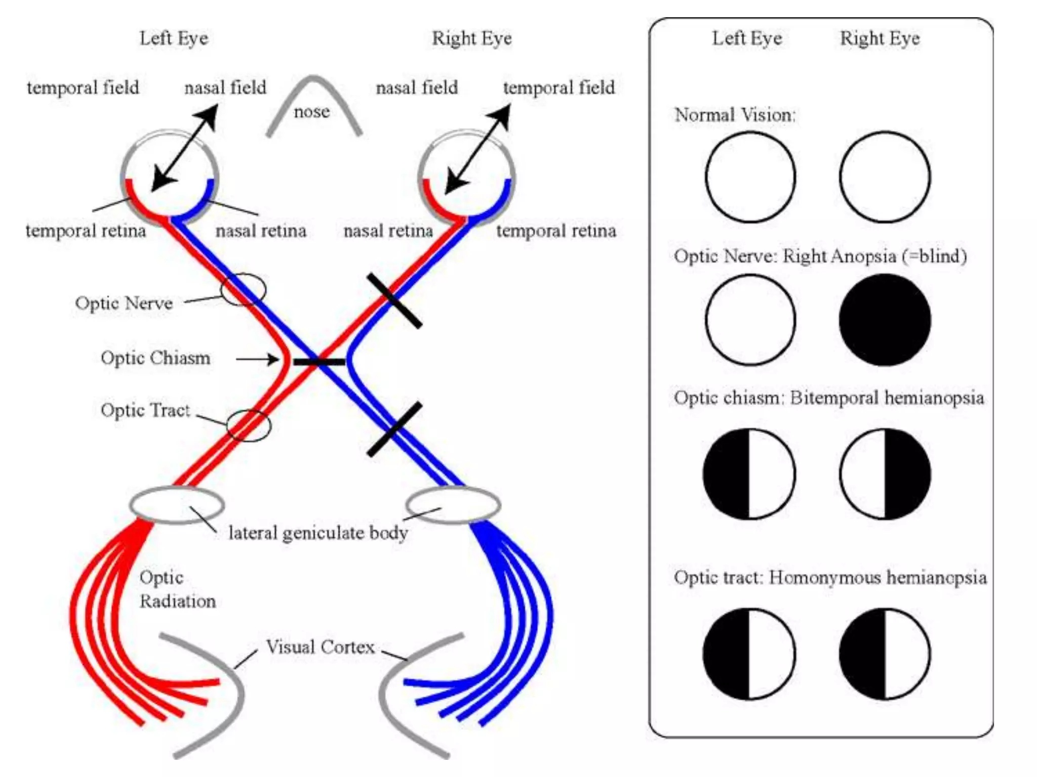 Visual pathway ,visual cortex and hemianopias | PPTX