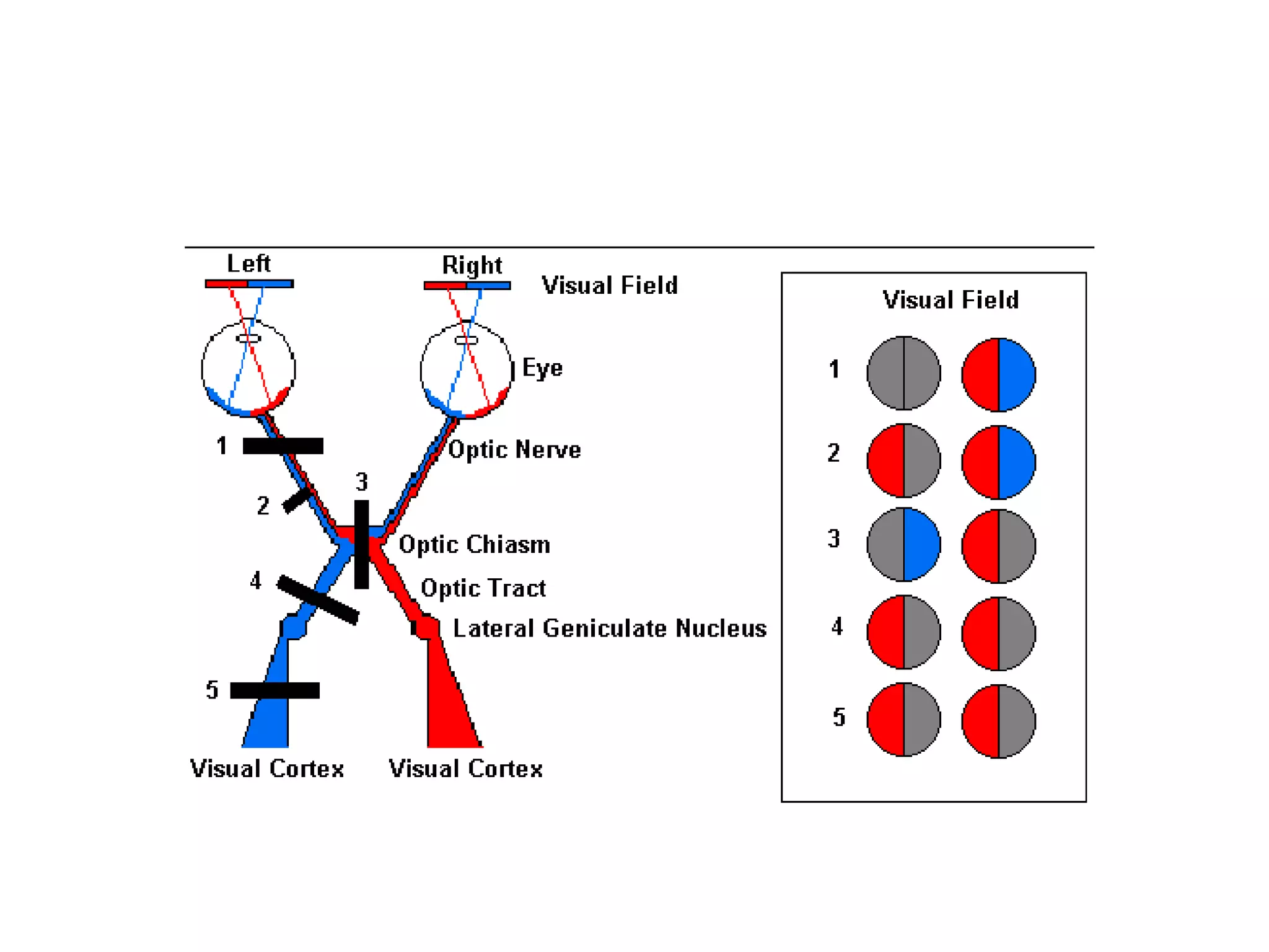 Visual pathway ,visual cortex and hemianopias | PPTX