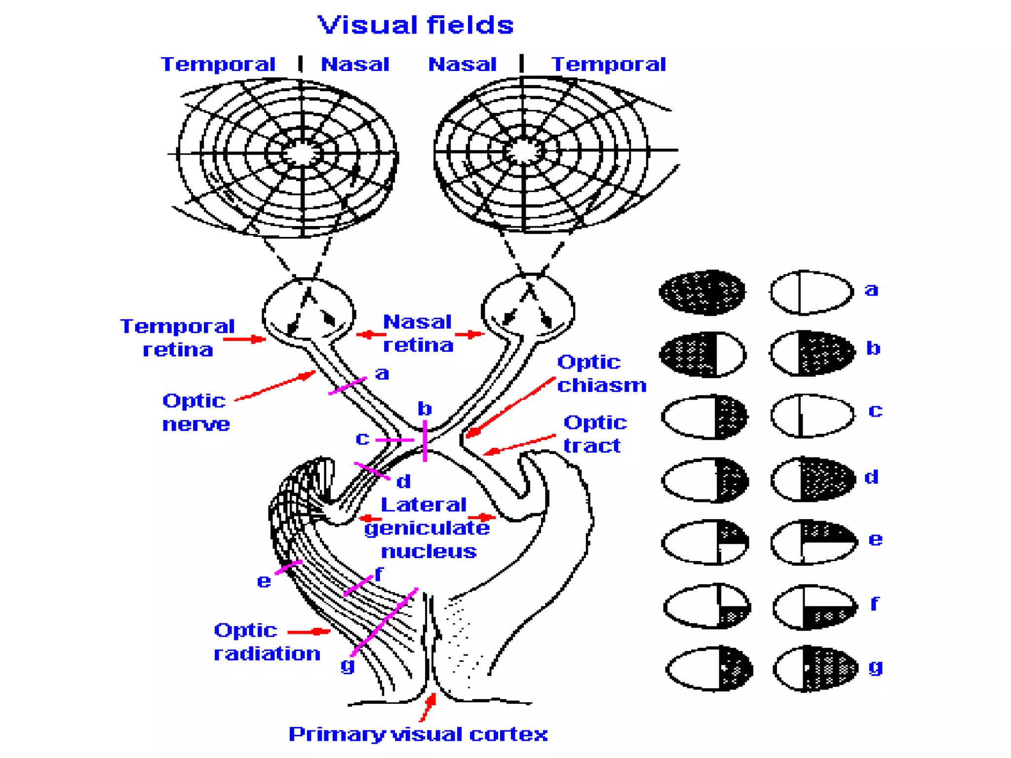 Visual pathway ,visual cortex and hemianopias | PPTX