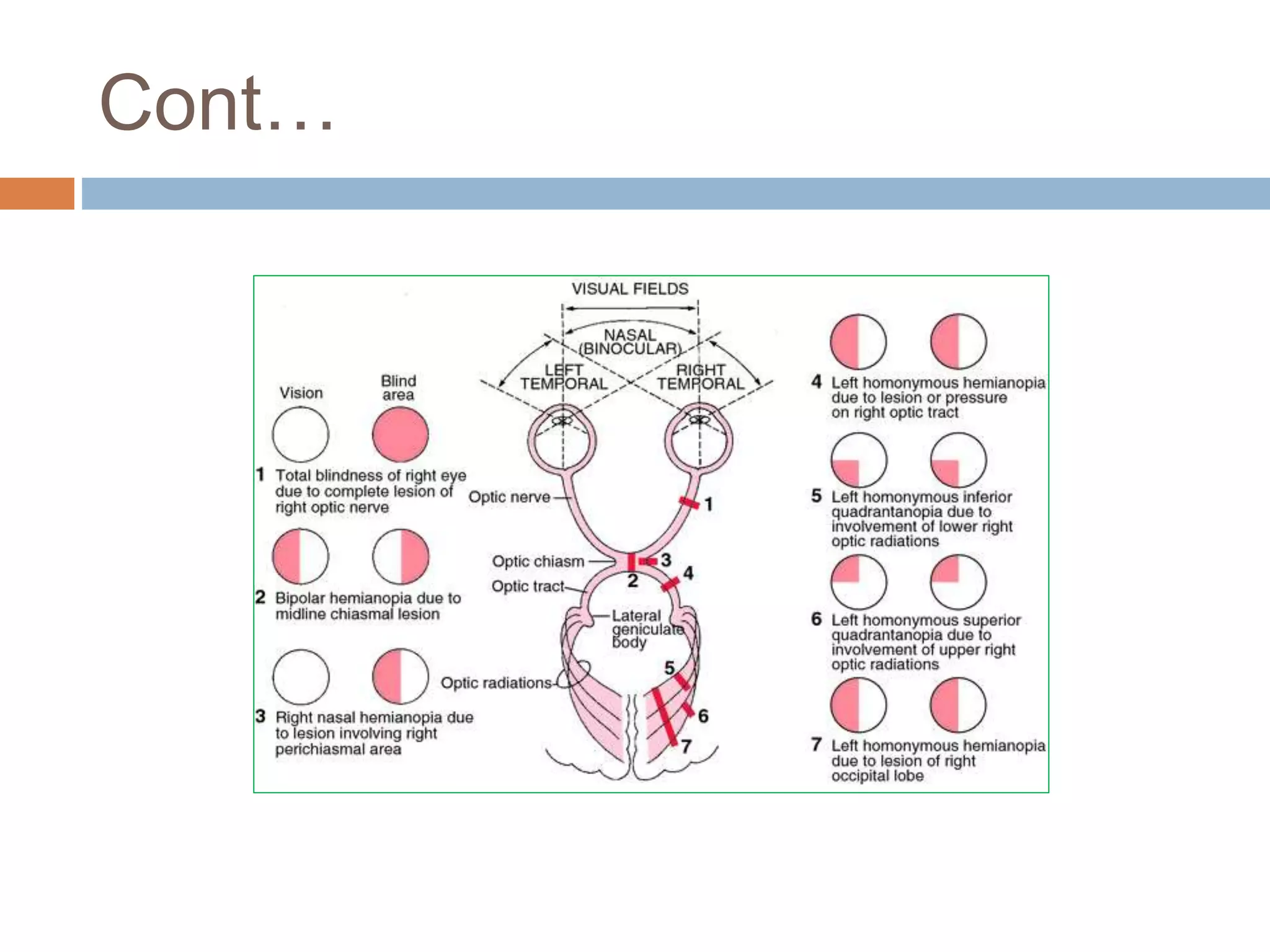 Visual pathway and its defects | PPTX