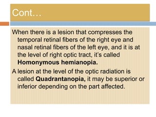 Visual pathway and its defects | PPTX