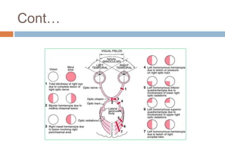 Visual pathway and its defects | PPTX