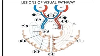 visual Pathway.pptx
